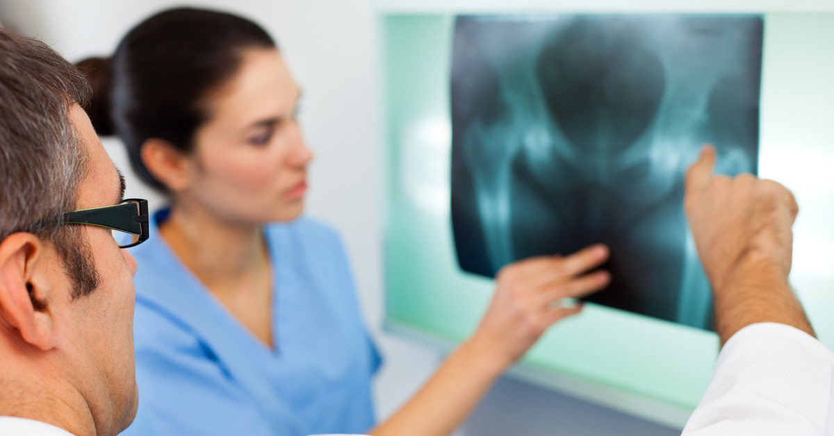 PAO Surgery (Periacetabular Osteotomy): HSS Hip Preservation