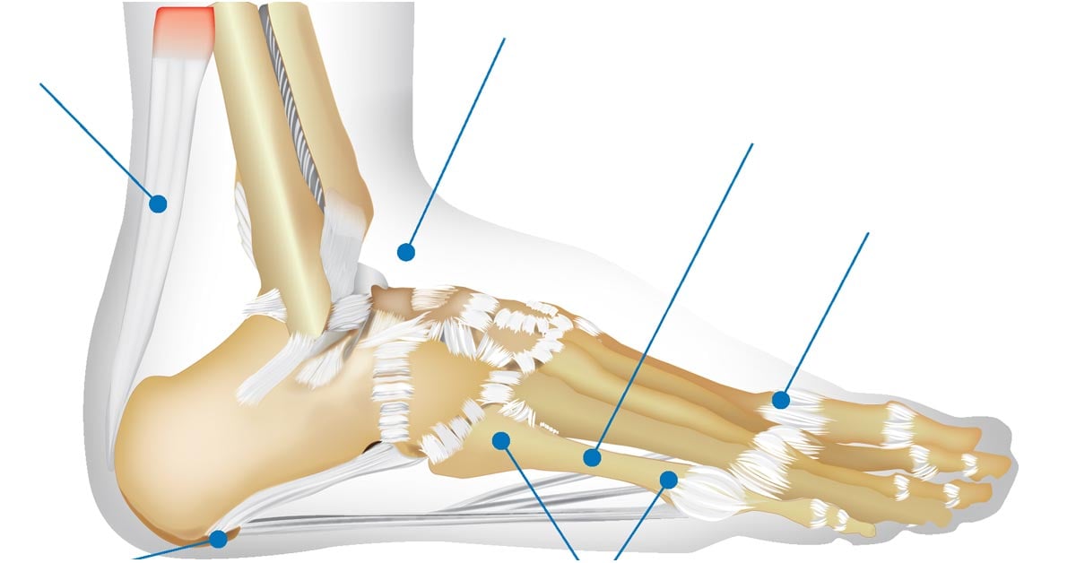 Foot Pain Conditions, Causes, Symptoms, Treatments