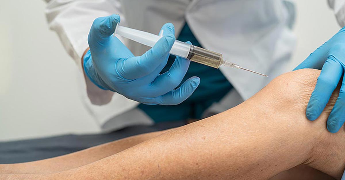 What to Know About Knee Gel Injections (Viscosupplementation)